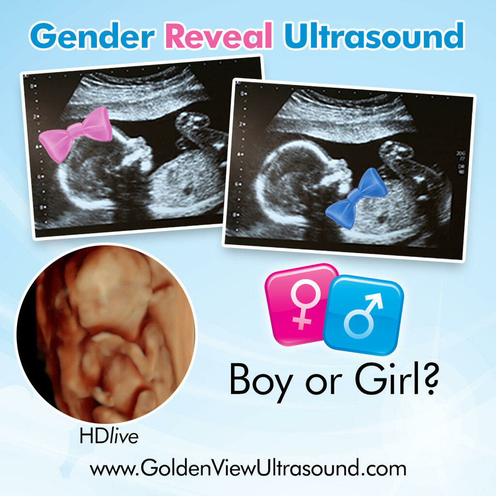 Hamilelik ürünleri Goldenview Ultrasound 3d/4d/HDlive San Antonio, San Antonio, foto