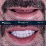 Alan Clinic (Sancaktepe, 885. Sk 2-12, 34200 Bağcılar/İstanbul 34100, 885. Sk No:2 D:12, 34200 Bağcılar/İstanbul), özel ağız ve diş sağlığı klinikleri ve muayenehaneleri  İstanbul'dan