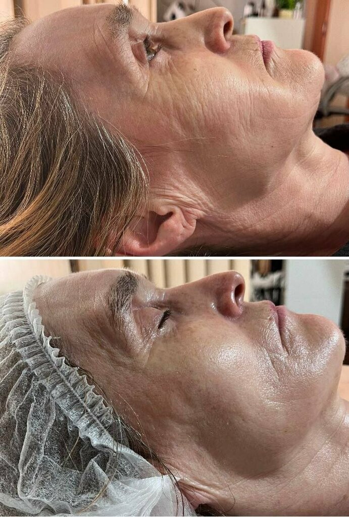 Kozmetoloji, kozmetik salonları Орхидея, Himki, foto