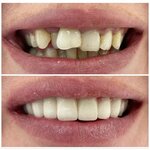 Marmaris Dentals (Muğla, Marmaris, Tepe Mah., 54. Sok., 1/1), özel ağız ve diş sağlığı klinikleri ve muayenehaneleri  Marmaris'ten