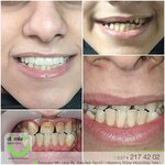 Di Smile Ağız ve Diş Sağlığı Polikliniği (Bolu, Bolu Merkez, Karaçayır Mah., Ulus Sok., 11/C), özel ağız ve diş sağlığı klinikleri ve muayenehaneleri  Bolu'dan