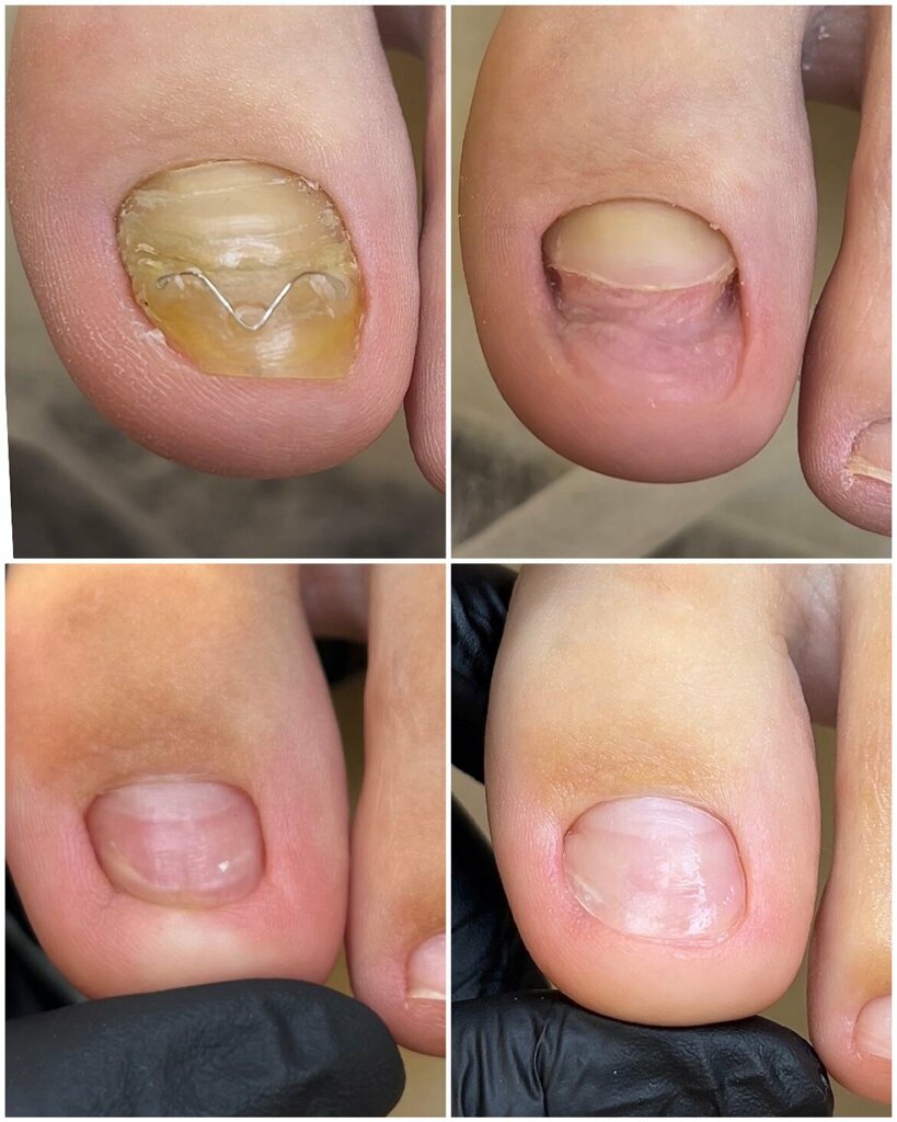 Manikür-pedikür Кабинет подолога Инны Мамаевой, Moskova, foto