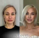 Skin Expert (Krasnoarmeyskaya Street No:4/1, Gagarina Microdistrict), kozmetoloji, kozmetik salonları  Soçi'den