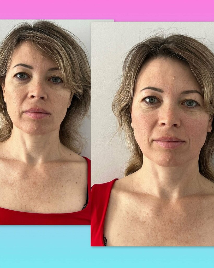 Kozmetoloji, kozmetik salonları Ruchnaya plastika litsa i tela, Moskova, foto