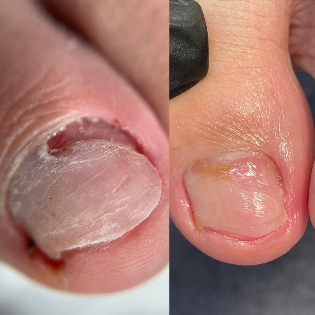 Podoloji Кабинет подолога, Omsk, foto