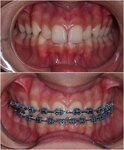 The Dental Boutique (M1, Cluster M, Jumeirah Lakes Towers, Al Thanyah 5, Al Thanyah, Hadaeq Mohammed Bin Rashid, Dubai), özel ağız ve diş sağlığı klinikleri ve muayenehaneleri