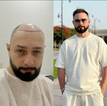 Hair Clinic (Yaroslavskoye Highway No:12к2), tıp merkezleri ve klinikler  Moskova'dan
