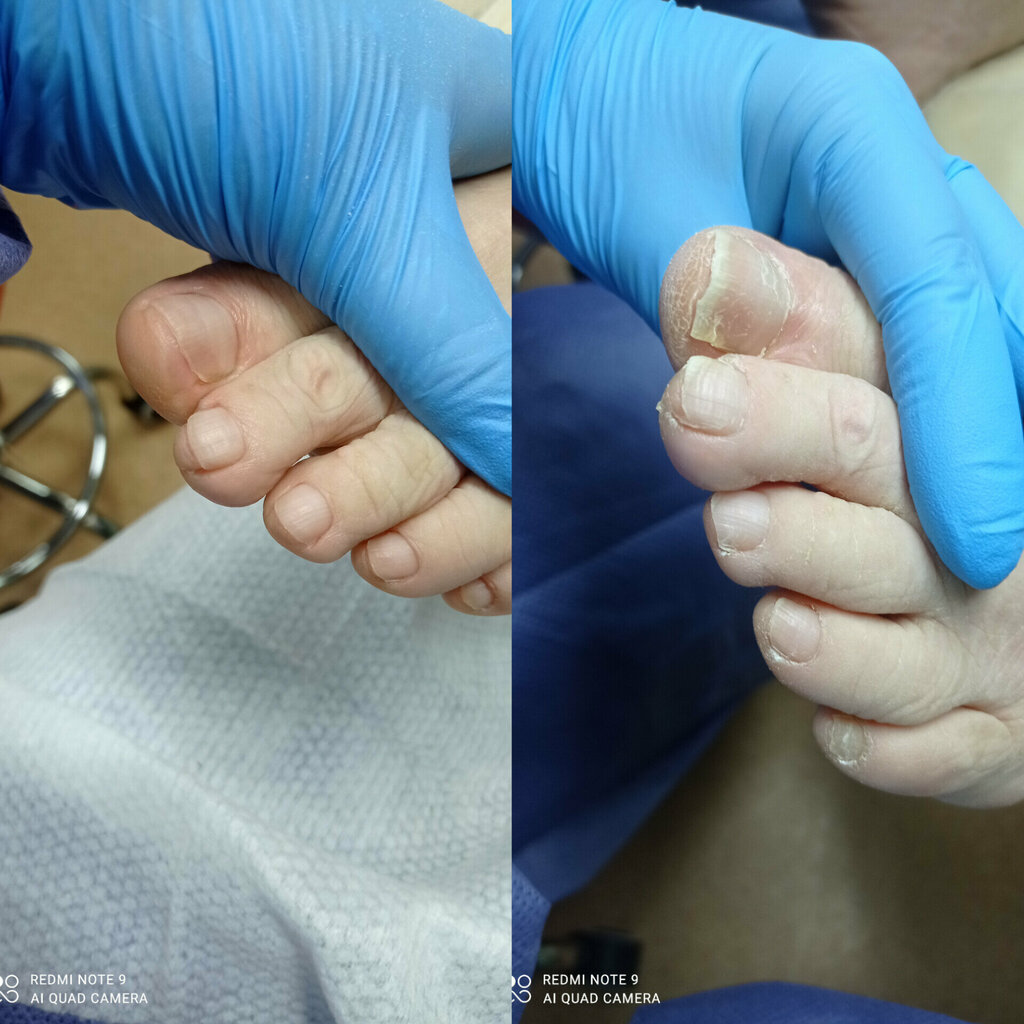 Podoloji Подолог Блинкова, Klin, foto