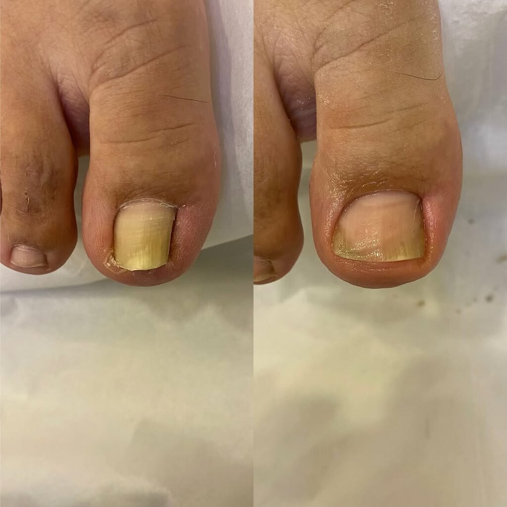 Podoloji Serkan Karaaslan Ayak Bakım Merkezi, Ankara, foto