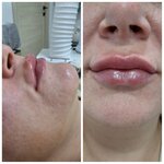 Posad Estetik (ulitsa Kalyayeva No:3А), kozmetoloji, kozmetik salonları  Pavlovski Posad'dan