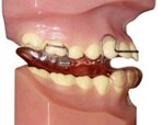 Orthodontiepraktijk Deventer (Brink No:24, Deventer), özel ağız ve diş sağlığı klinikleri ve muayenehaneleri  Overijssel'den