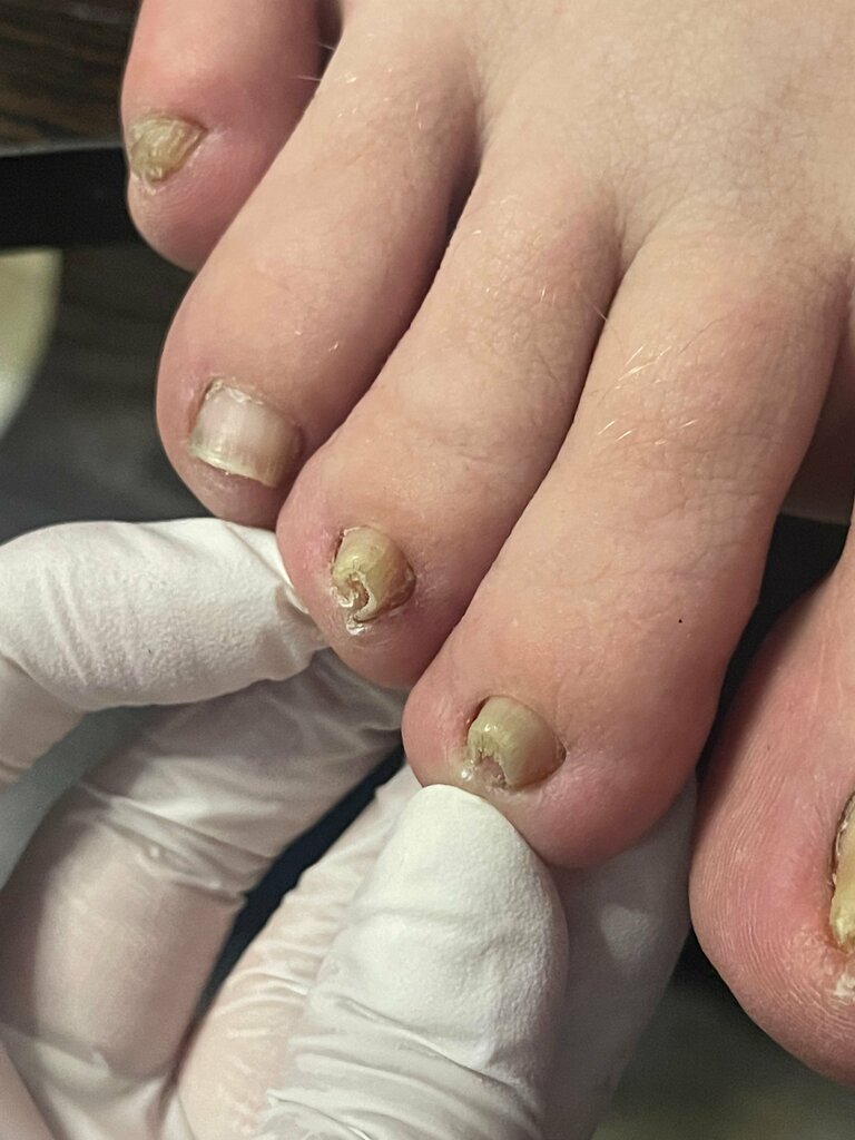 Podoloji Кабинет подолога, Omsk, foto