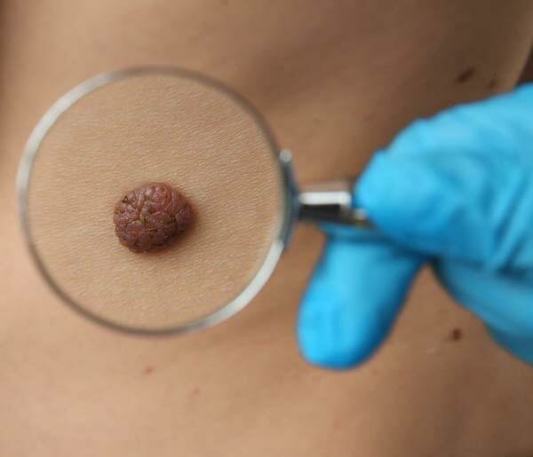 Tıp merkezleri ve klinikler Fruttero Dott. ssa Rosalba - Dermatologa, Cuneo, foto