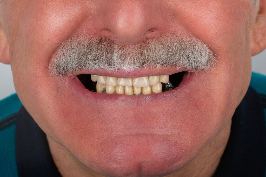 Özel ağız ve diş sağlığı klinikleri ve muayenehaneleri Royal Dental Care, Dubai, foto
