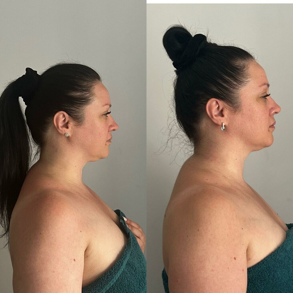 Kozmetoloji, kozmetik salonları Ruchnaya plastika litsa i tela, Moskova, foto