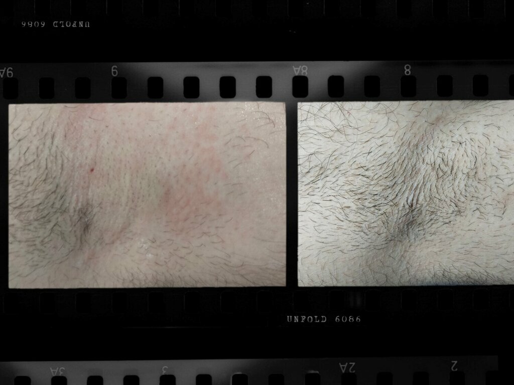 Epilasyon Электроэпиляция, Ulyanovsk, foto