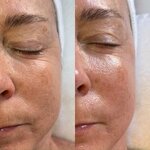 Zamina Musaeva cosmetology (Aytiev Street No:154/1), kozmetoloji, kozmetik salonları  Almatı'dan