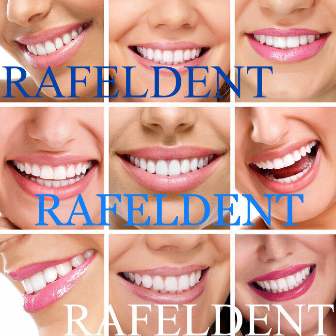 Özel ağız ve diş sağlığı klinikleri ve muayenehaneleri Clínica Dental Rafeldent, Valensiya, foto
