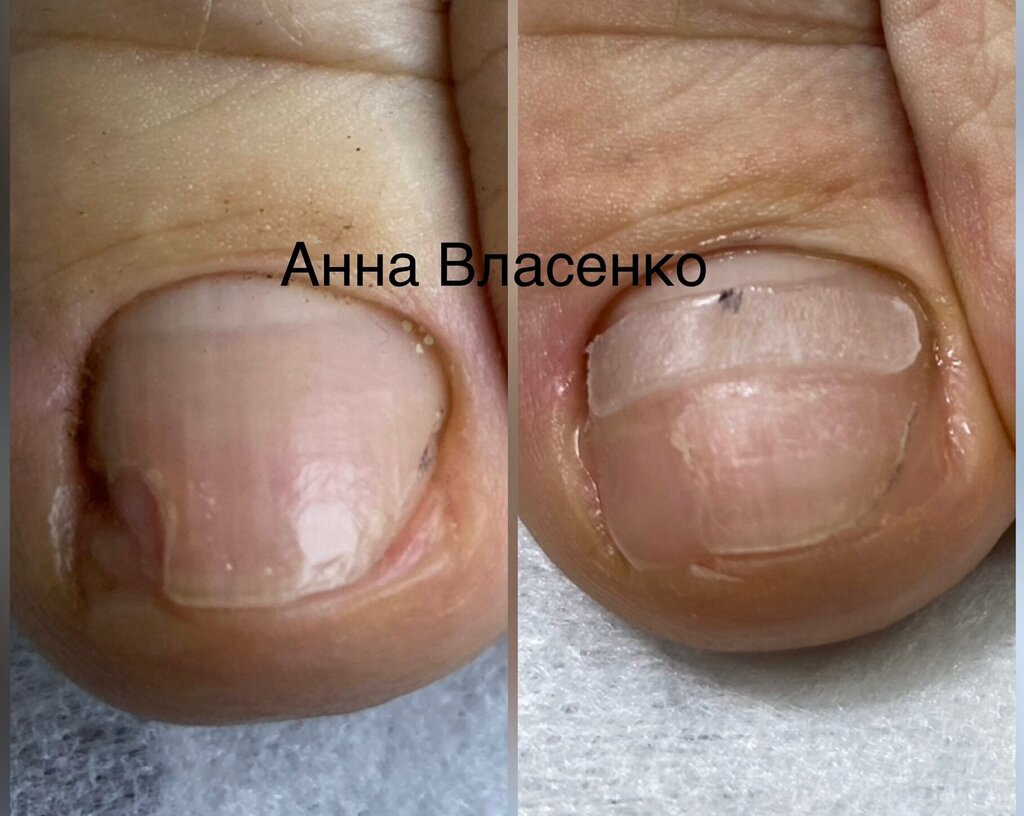 Podoloji Подолог-эстетист Власенко А. А., Krasnodarski krayı, foto