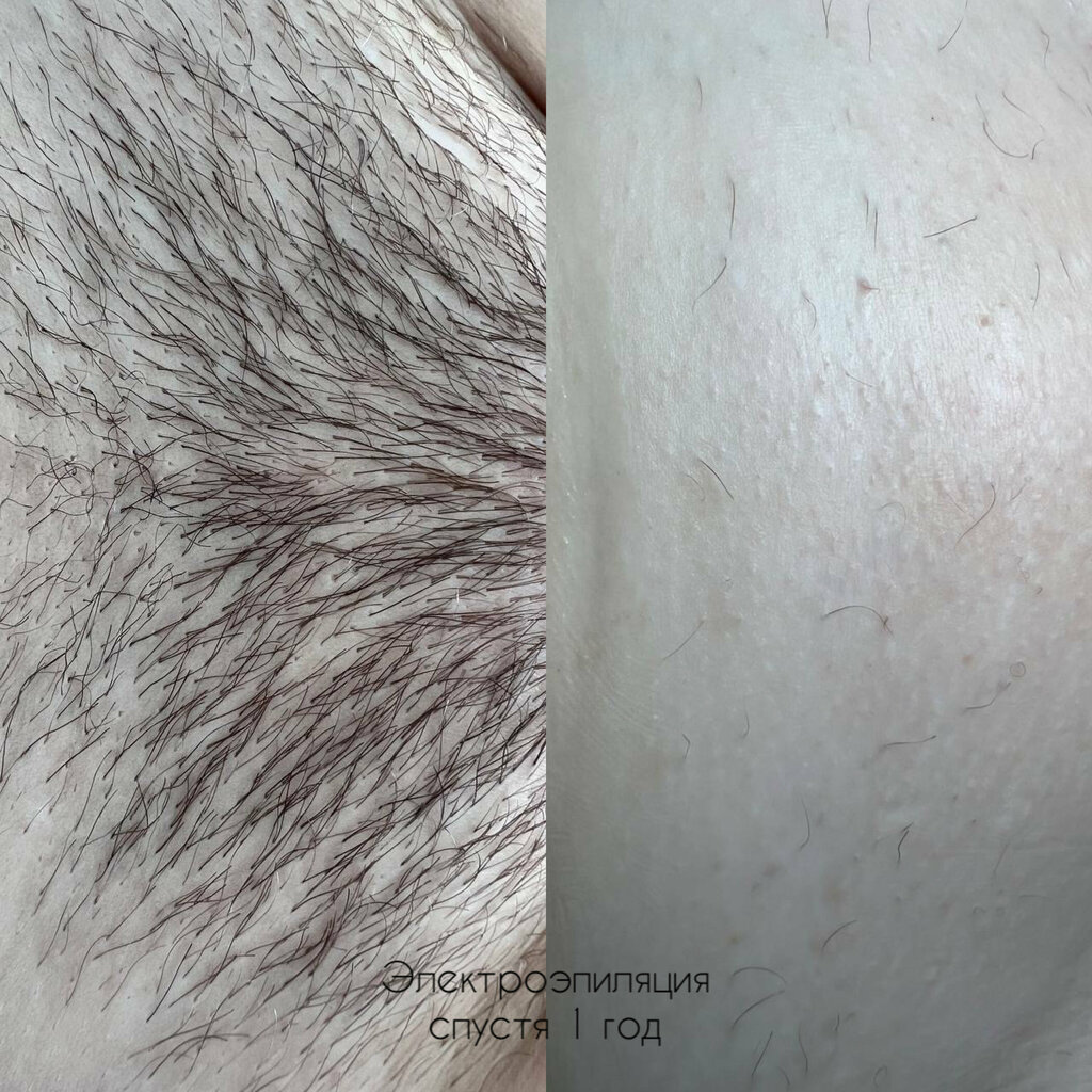 Epilasyon Студия эпиляции Ольги Исаковой, Arhangelsk, foto