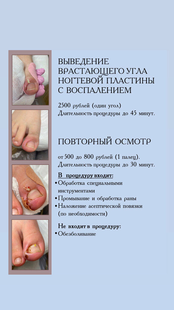 Podoloji Подолог Назина А. С., Temriuk, foto