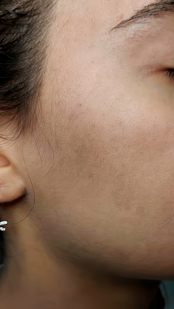 Epilasyon Aylin, Balaşiha, foto