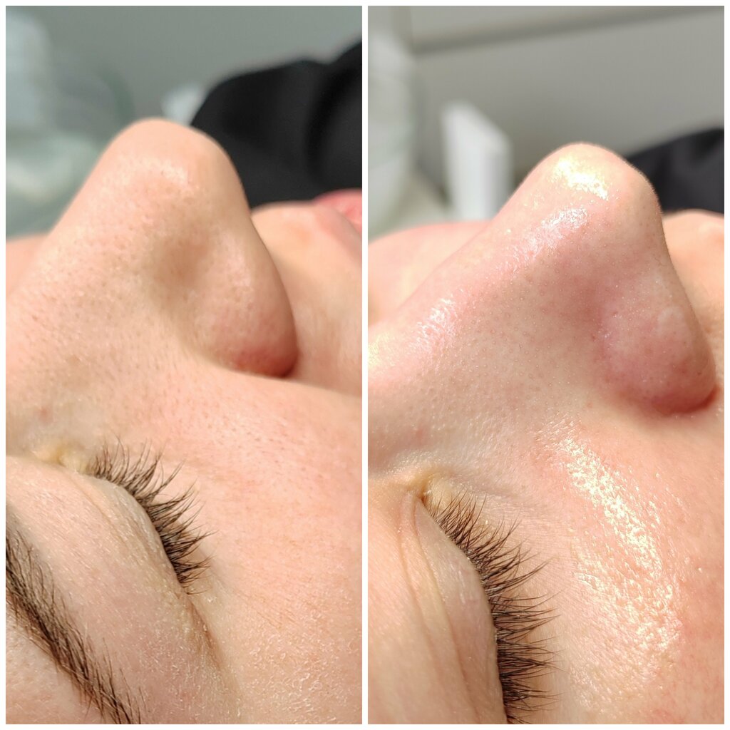 Kozmetoloji, kozmetik salonları Cosmo.Lori, Yekaterinburg, foto