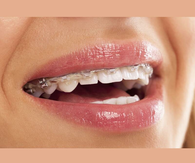 Özel ağız ve diş sağlığı klinikleri ve muayenehaneleri Studio Dentistico Associato Dr. Maurizio Baldo e Dr. Paolo Tregnago, Dünya, foto