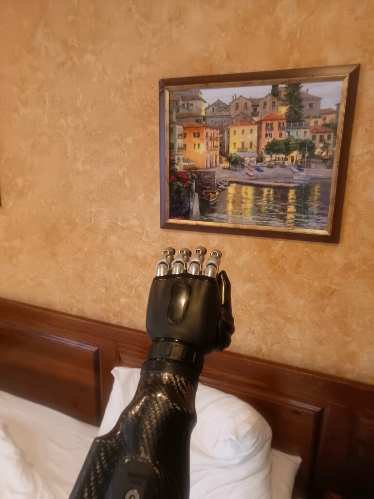 Protez yapımı Metiz Impex, Mytişçi, foto