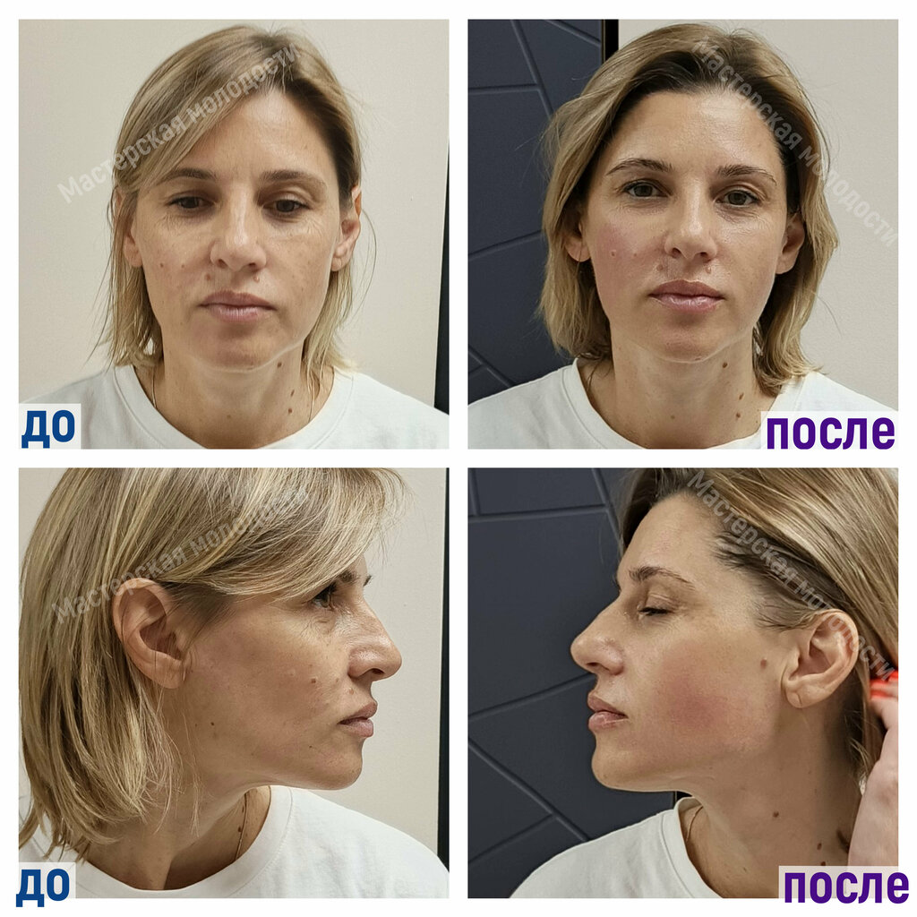 Kozmetoloji, kozmetik salonları Мастерская молодости, Moskova, foto