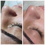 Epidermis Lazer Epilasyon (Aksaray, Aksaray Merkez , Ereğlikapı Mah., 1405. Sok., 8A), güzellik salonu  Aksaray'dan