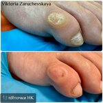 ПЯточки (prospekt Lenina No:100), podoloji  Briansk'tan