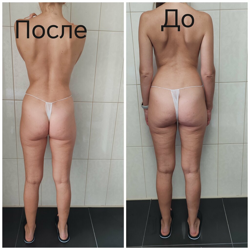 Masaj salonları Кабинет Lpg, Yekaterinburg, foto