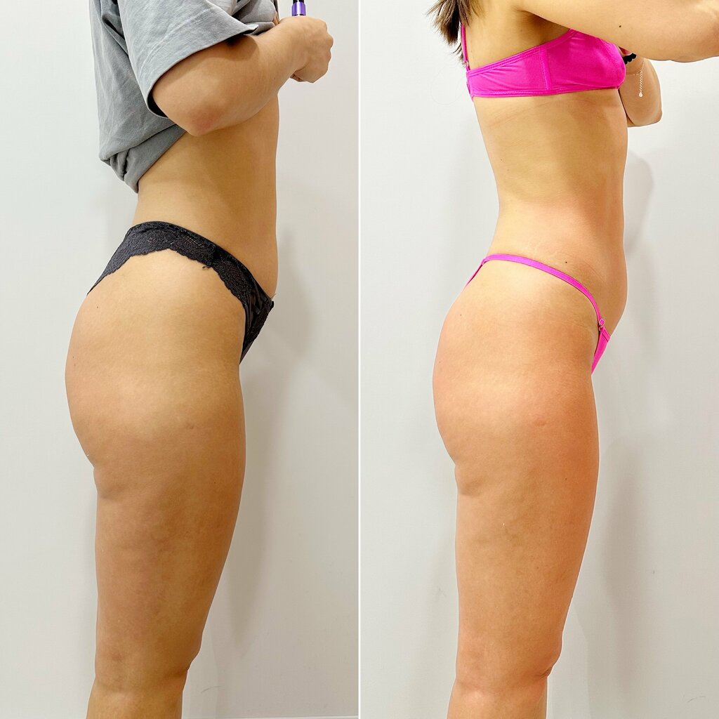 Epilasyon Студия эстетики тела и лица Оксаны Матвеевой, Samara, foto