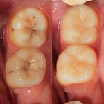 Yes dental (Abaı kóshesi No:128), özel ağız ve diş sağlığı klinikleri ve muayenehaneleri  Kökşetav'dan