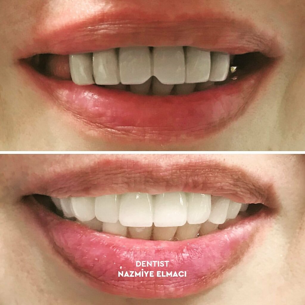 Özel ağız ve diş sağlığı klinikleri ve muayenehaneleri Beyaz Estetik Ağız ve Diş Sağlığı Polikliniği, Antalya, foto