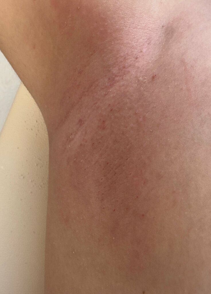 Epilasyon Восковая депиляция, Saint‑Petersburg, foto