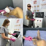 Лазерная эпиляция/воск/шугаринг (ulitsa Trudovoy Slavy No:62Ак1), güzellik salonu  Krasnodar'dan