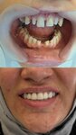 Özel Çok Amaçlı İnci Dental Diş Laboratuvarı (Eskişehir, Tepebaşı, Mustafa Kemal Paşa Mah., Doğancan Sok., 10B), özel ağız ve diş sağlığı klinikleri ve muayenehaneleri  Eskişehir'den