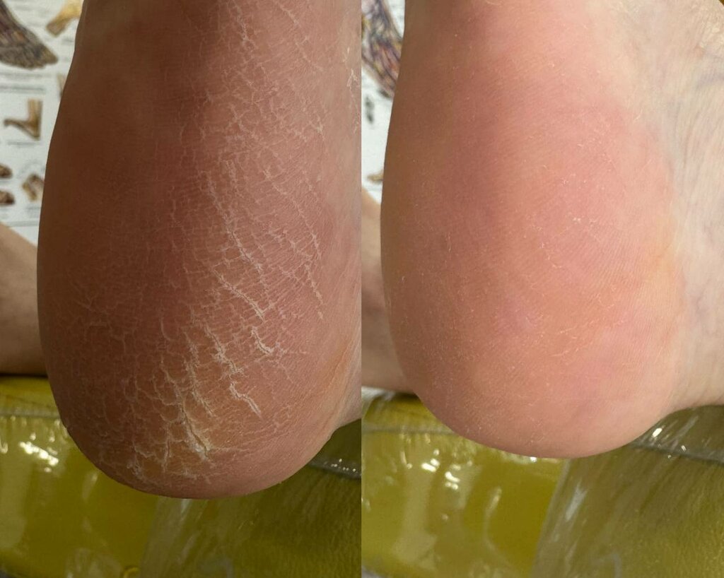 Podoloji Центр подологии, Novosibirsk, foto