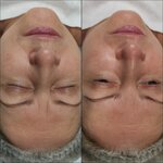 Валерия (ulitsa Svobody No:5, posyolok gorodskogo tipa Mirny), kozmetoloji, kozmetik salonları  Moskova ve Moskovskaya oblastından