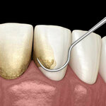 Dental Clinic Serkan Kılınç (Antalya, Alanya, Güller Pınarı Mah., Yağcılar Sok., 2A), özel ağız ve diş sağlığı klinikleri ve muayenehaneleri  Alanya'dan