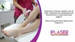 IPlaser (Mira Street No:44А), epilasyon  Penza'dan