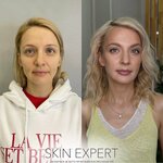 Skin Expert (ulitsa Trudovoy Slavy No:4), kozmetoloji, kozmetik salonları  Soçi'den
