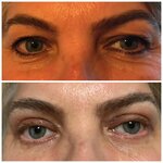 Eye Care Istanbul (İstanbul, Sultangazi, 75. Yıl Mah., İstiklal Cad., 16), göz sağlığı merkezleri  İstanbul'dan