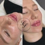 Svetlana's author's Cosmetology (проспект Победы No:61А), kozmetoloji, kozmetik salonları  Simferopol'dan (Akmescit'ten)