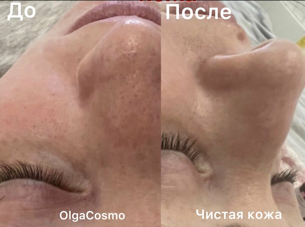 Kozmetoloji, kozmetik salonları Olga Cosmo, Zelenograd, foto