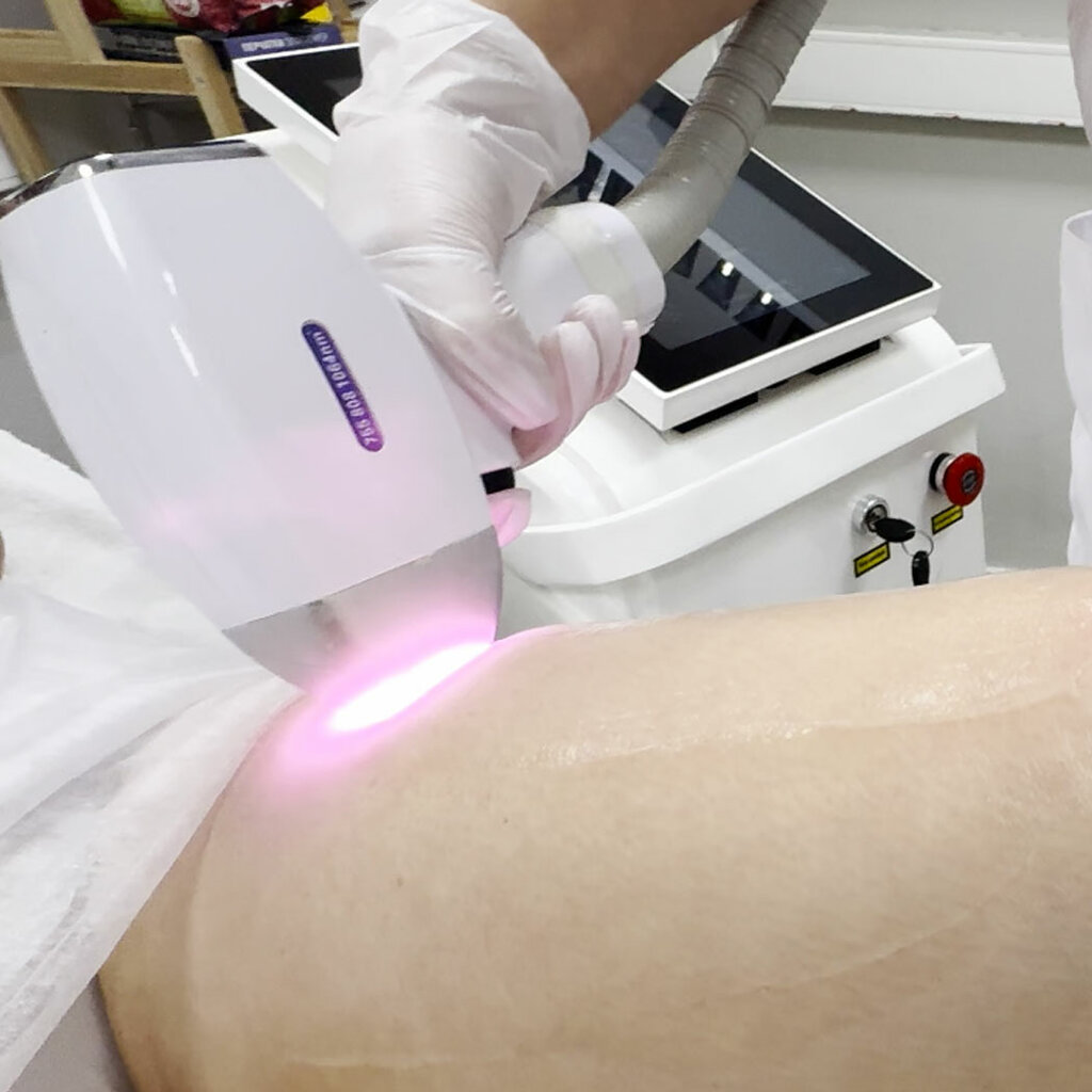 Epilasyon Laser Epilaz, Moskova, foto