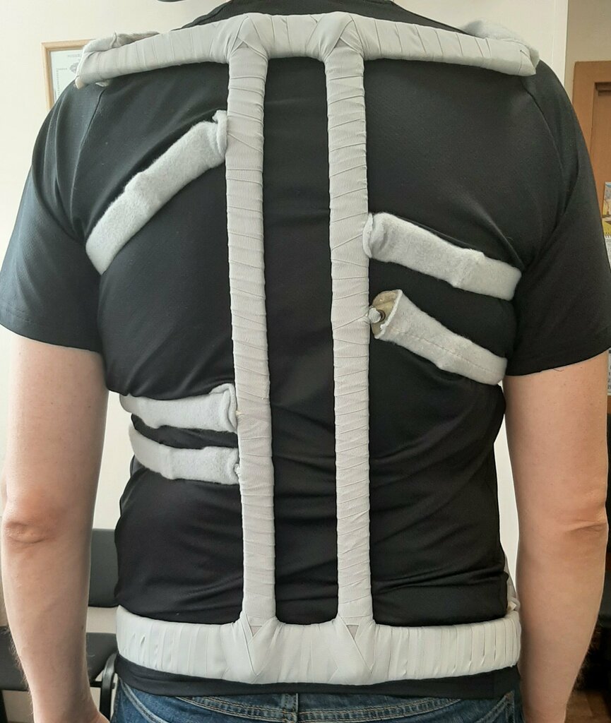Protez yapımı OrthoTech Spine Lab, Zelenograd, foto