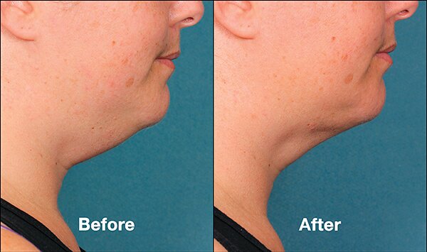 Spa Skin Care and Laser Physicians of Beverly Hills, Los Angeles, foto